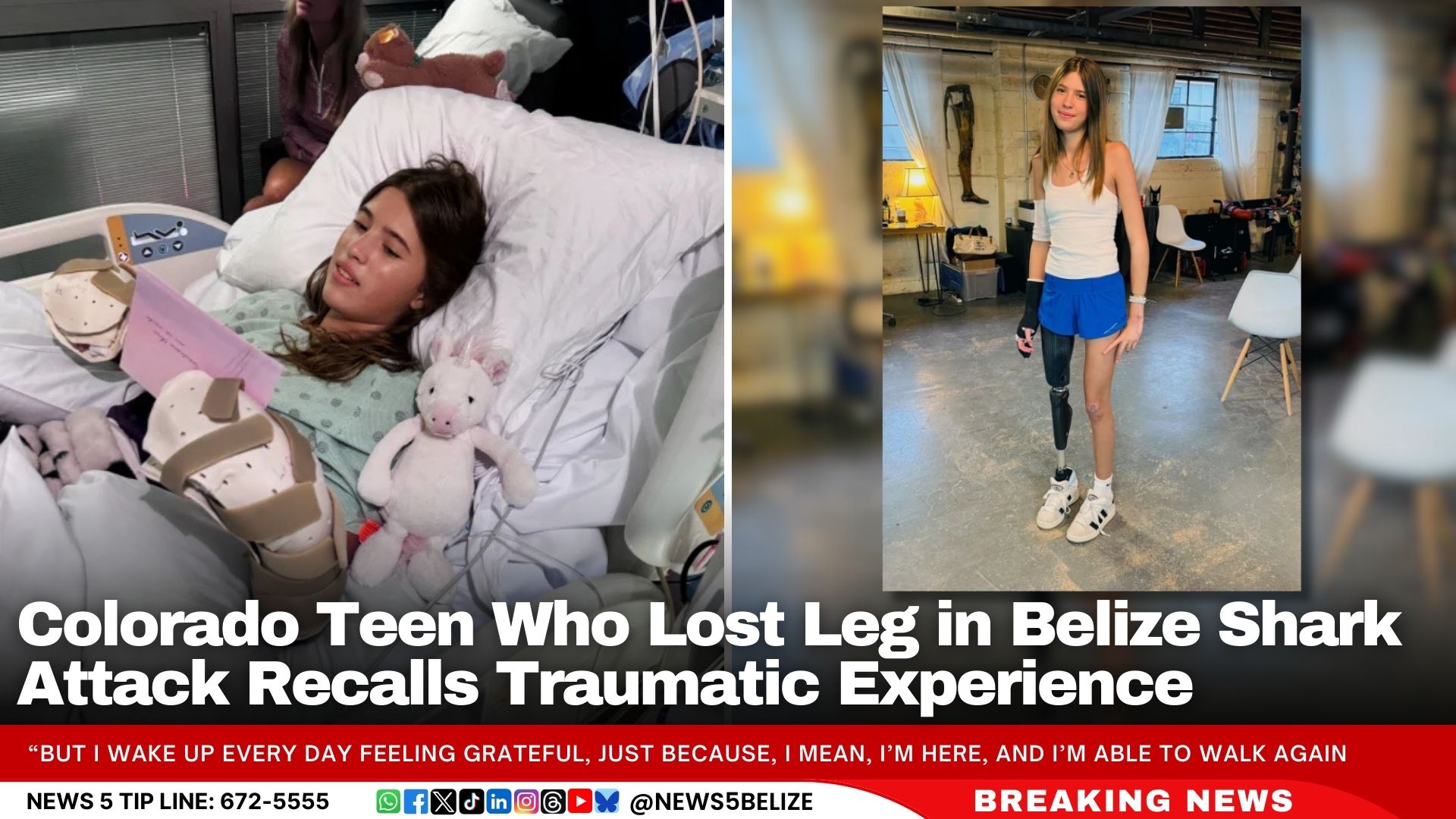 Colorado Teen Who Lost Leg in Belize Shark Attack Recalls Traumatic ...