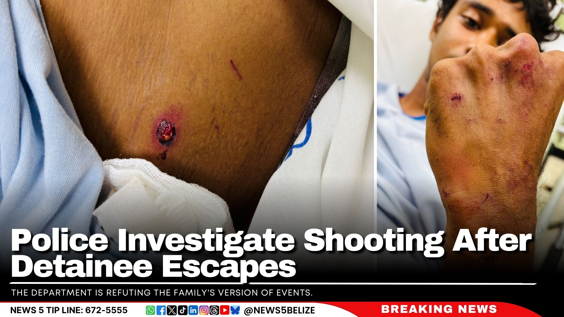 Police Investigate Shooting After Detainee Escapes | Greater Belize Media