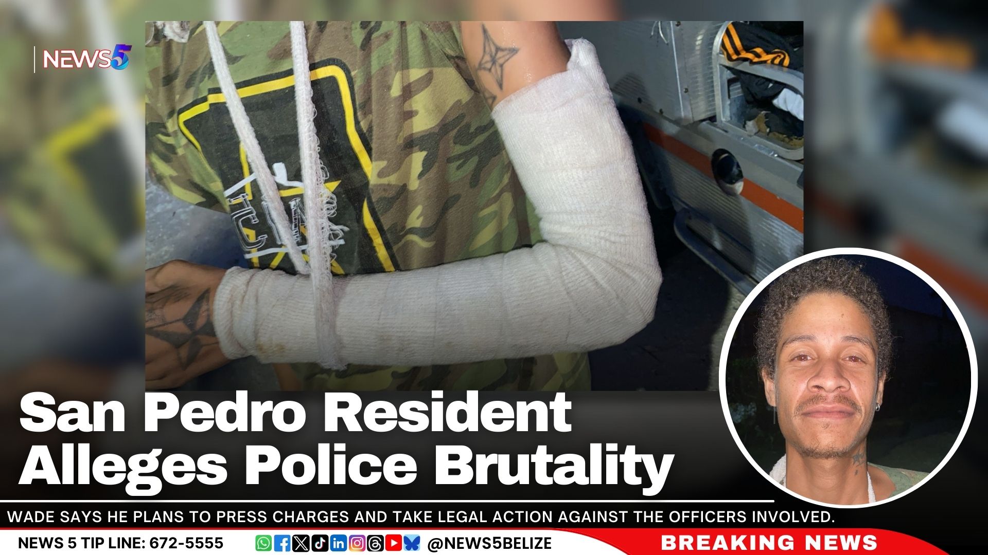San Pedro Resident Alleges Police Brutality | Greater Belize Media